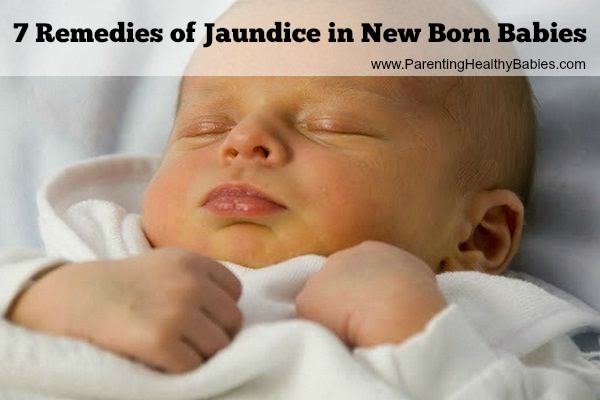 7 Remedies of Jaundice in New Born Babies