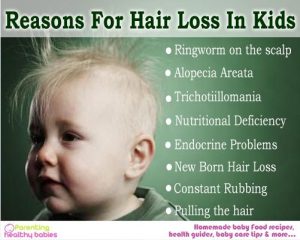 8 Must Know Causes for Hair Loss in Children