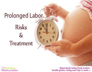Prolonged Labor: Risks and Treatment