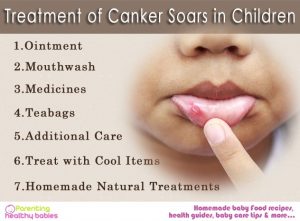 Cause and Treatment of Canker Sores in Children
