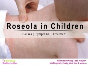 Roseola in Children: Causes, Symptoms and Treatment