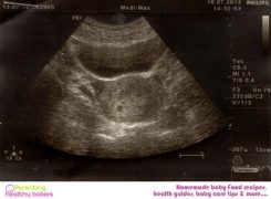 Third Trimester - Week by Week Pregnancy