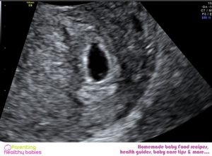 Week 5 of Pregnancy: Pregnancy Week by Week