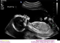 Week 20 of Pregnancy – Pregnancy Week by Week