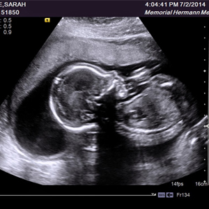 WEEK 27 OF PREGNANCY – PREGNANCY WEEK BY WEEK