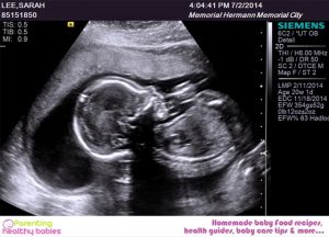 Week 27 of Pregnancy – Pregnancy Week by Week