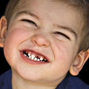11 Natural Remedies to Stop Teeth Grinding (Bruxism) in Children