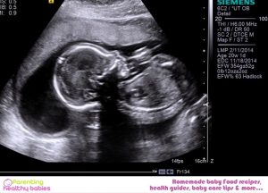 Week 41 Of Pregnancy – Pregnancy Week By Week