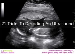 21 Tricks To Decoding An Ultrasound