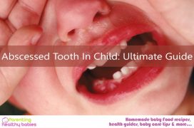 Abscessed Tooth In Child: Ultimate Guide