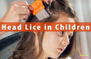 Head Lice in Children: Symptoms, Causes, Diagnosis and Treatments