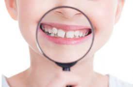 7 unforseen Causes Behind Stained Teeth in Children