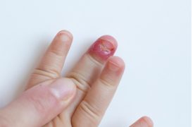 Staph Infection in Children: Everything You Need to Know