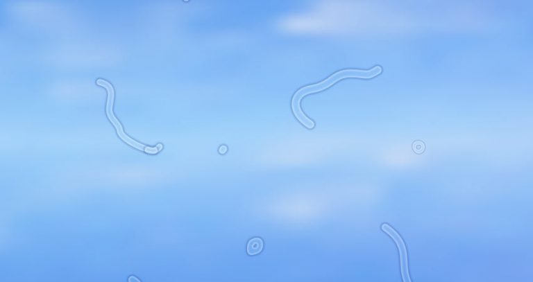 Eye Floaters: Causes, Symptoms, Treatment and Remedies