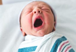 Salmon Patch or Angel Kiss in newborns: Symptoms and Treatment