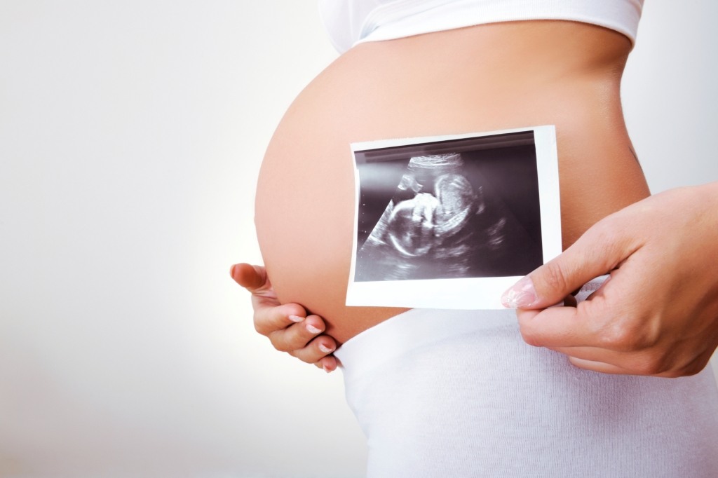 Vanishing Twin Syndrome