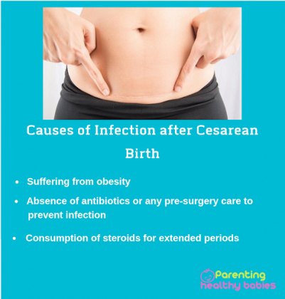 Post-Cesarean Wound Infection | Parentinghealthybabies.com