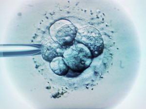 Embryo Transfer: Procedure, Risks and Precautions