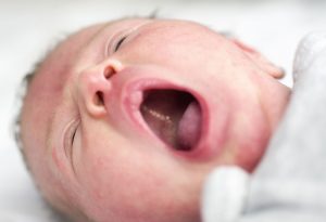 Epstein Pearls in Babies: Signs, Causes & Treatment