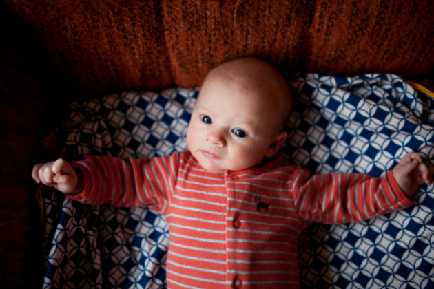 Umbilical Granuloma: Symptoms, Complications And Treatment